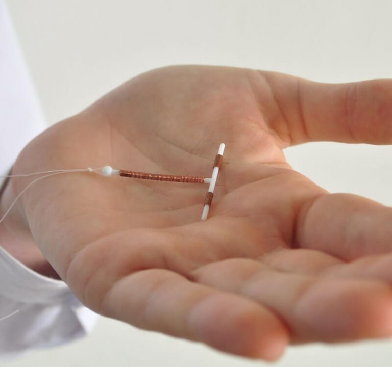 IUD Removal: What to Expect - GYN Women's Centre